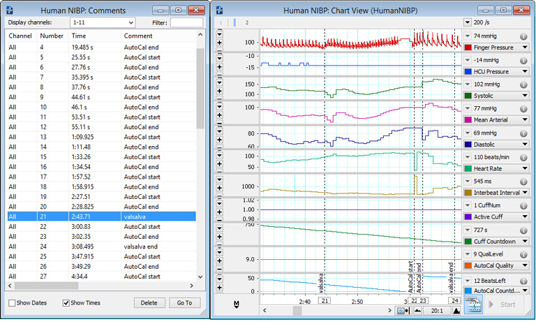 人非侵入性血压（NIBP）|adinstruments - ld乐动体育I网址